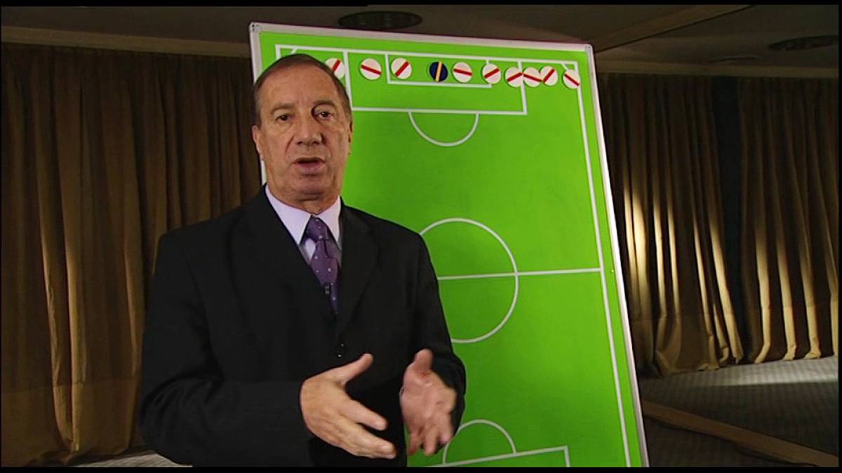 Qué es el síndrome Hakim-Adams que tiene Bilardo - AS.com